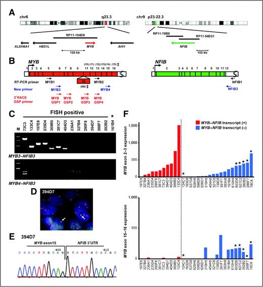 Novel Chromosomal Rearrangements and Break Points at the t(6;9) in ...