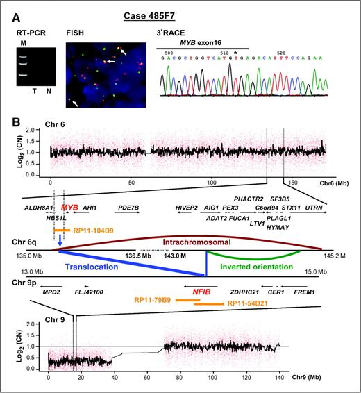 Novel Chromosomal Rearrangements and Break Points at the t(6;9) in ...