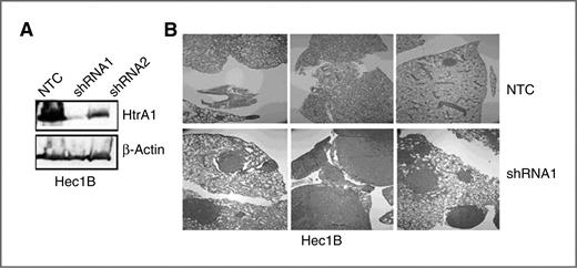 Expression and Functional Significance of HtrA1 Loss in Endometrial ...
