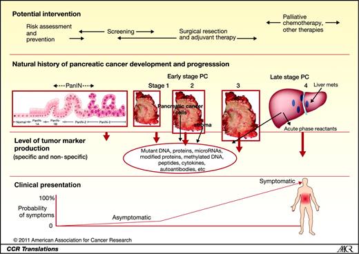 Markers of Pancreatic Cancer: Working Toward Early Detection | Clinical ...