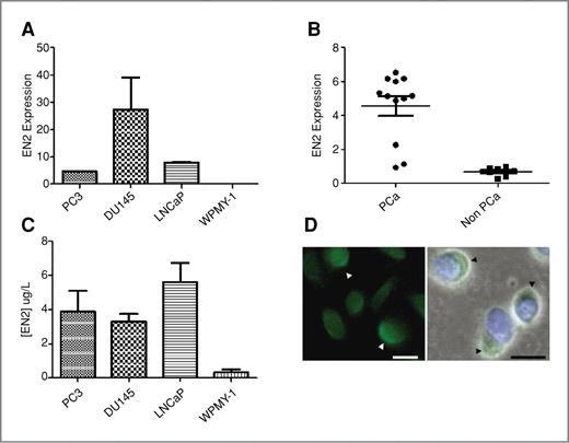 Engrailed-2 (EN2): A Tumor Specific Urinary Biomarker for the Early ...