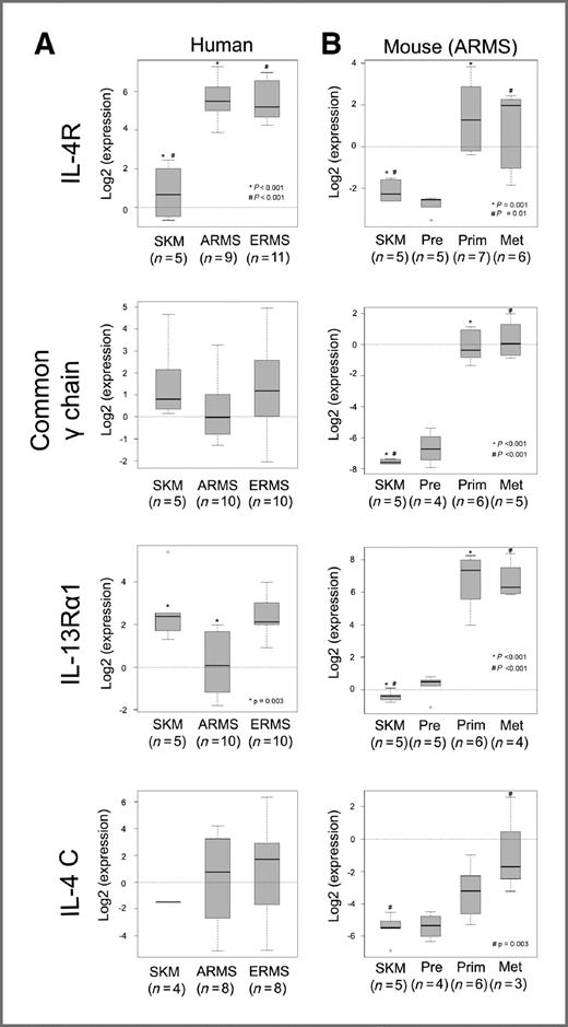 IL-4R Drives Dedifferentiation, Mitogenesis, and Metastasis in ...