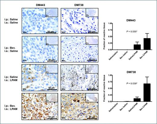 Bevacizumab-Induced Alterations in Vascular Permeability and Drug ...