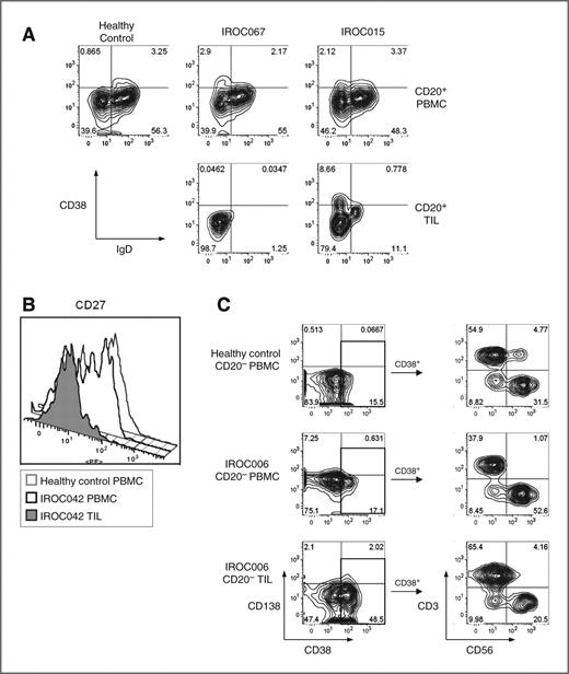 CD20+ Tumor-Infiltrating Lymphocytes Have an Atypical CD27− Memory ...