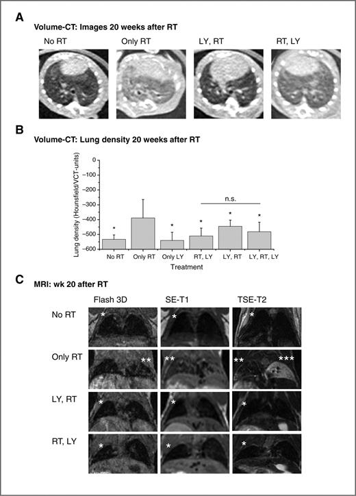 LY2109761 Attenuates Radiation-Induced Pulmonary Murine Fibrosis via ...