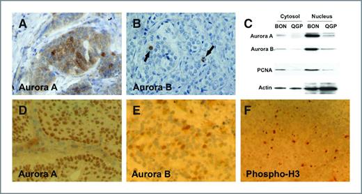 Targeting Aurora Kinases with Danusertib (PHA-739358) Inhibits Growth ...