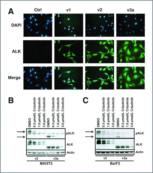 Differential Protein Stability and ALK Inhibitor Sensitivity of EML4 ...