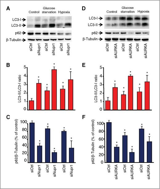 Nupr1-Aurora Kinase A Pathway Provides Protection against Metabolic ...