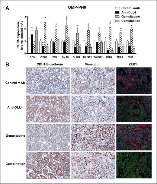 Anti-DLL4 Has Broad Spectrum Activity in Pancreatic Cancer Dependent on ...
