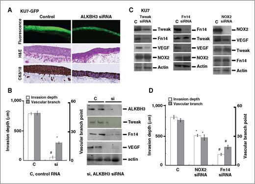 ALKBH3 Contributes to Survival and Angiogenesis of Human Urothelial ...