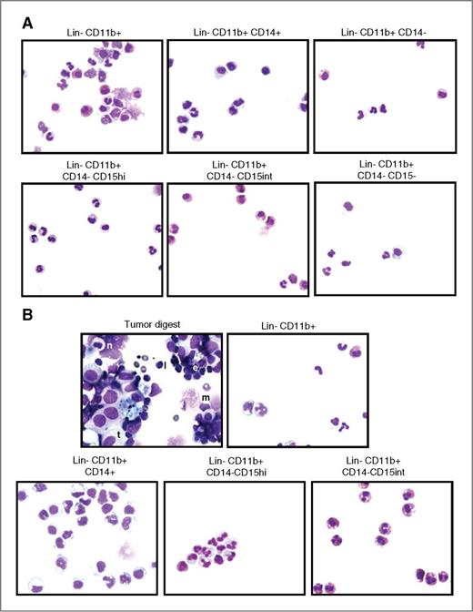 Myeloid Cells Obtained from the Blood but Not from the Tumor Can ...