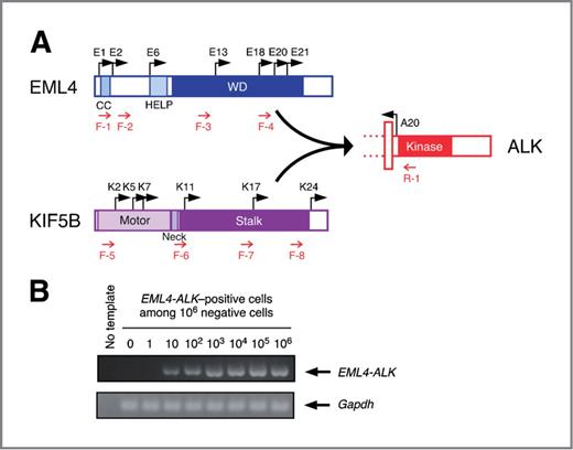 A Prospective PCR-Based Screening for the EML4-ALK Oncogene in Non ...