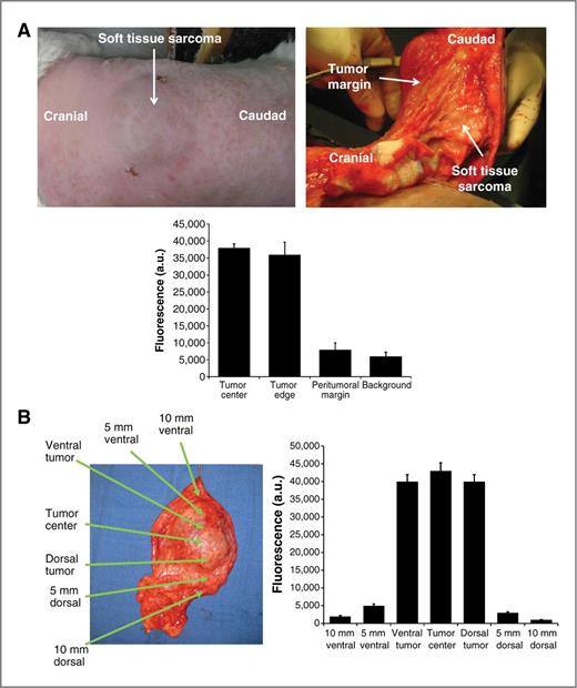 Intraoperative Near-Infrared Imaging of Surgical Wounds after Tumor ...