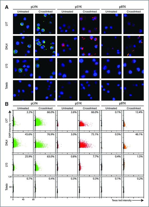 Quantitative Immunofluorescence Reveals the Signature of Active B-cell ...