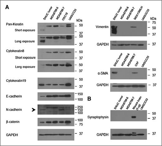 Establishment and Characterization of Novel Cell Lines from Sinonasal ...