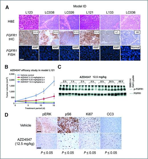 Translating the Therapeutic Potential of AZD4547 in FGFR1-Amplified Non ...