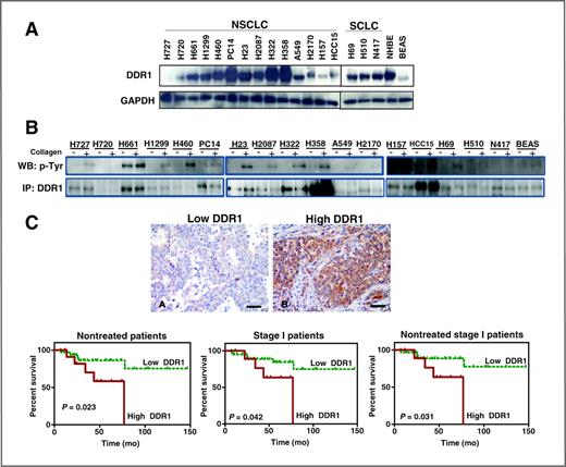 Inhibition of Collagen Receptor Discoidin Domain Receptor-1 (DDR1 ...