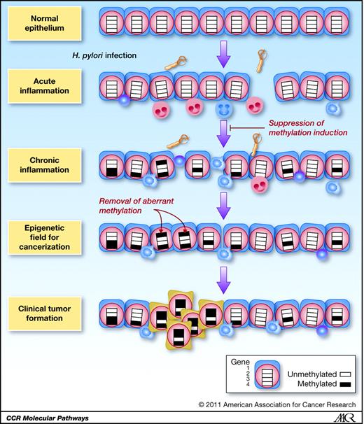 Molecular Pathways: Involvement of Helicobacter pylori–Triggered ...