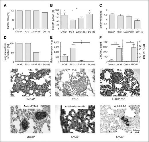 Human Prostate Cancer in a Clinically Relevant Xenograft Mouse Model ...