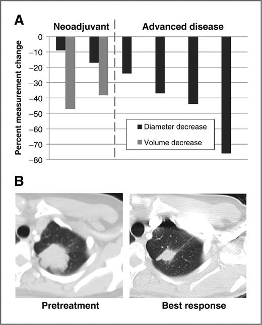 EGFR Exon 19 Insertions: A New Family of Sensitizing EGFR Mutations in ...