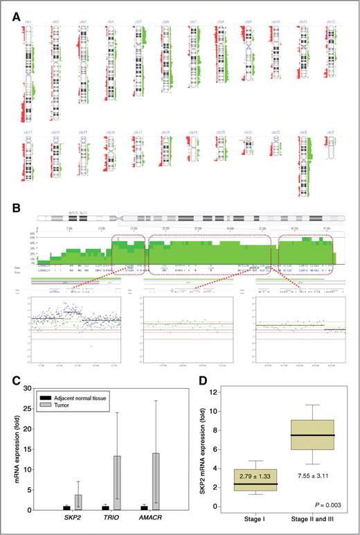 Characterization of Gene Amplification–Driven SKP2 Overexpression in ...