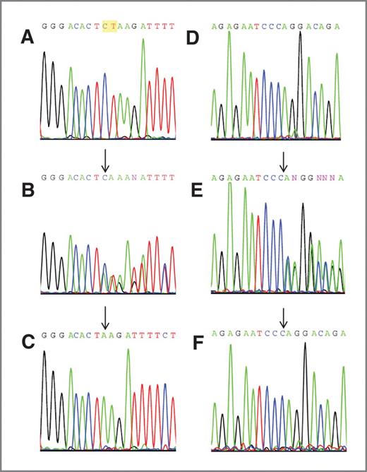 High Prevalence of BRCA1 and BRCA2 Germline Mutations with Loss of ...