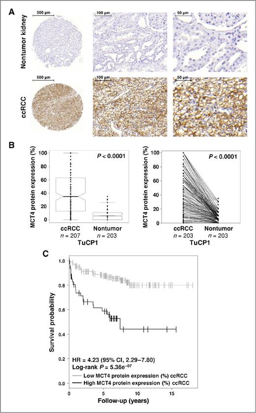 DNA Methylation of the SLC16A3 Promoter Regulates Expression of the ...