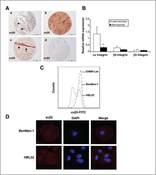 The Integrin Inhibitor Cilengitide Affects Meningioma Cell Motility and ...