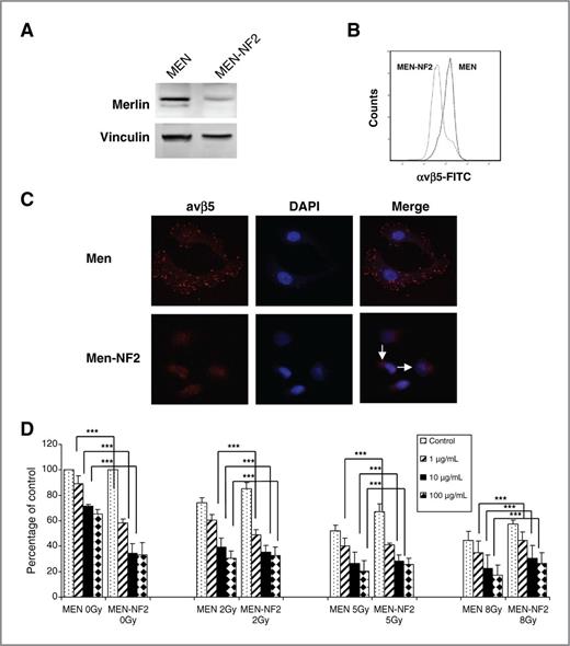 The Integrin Inhibitor Cilengitide Affects Meningioma Cell Motility and ...