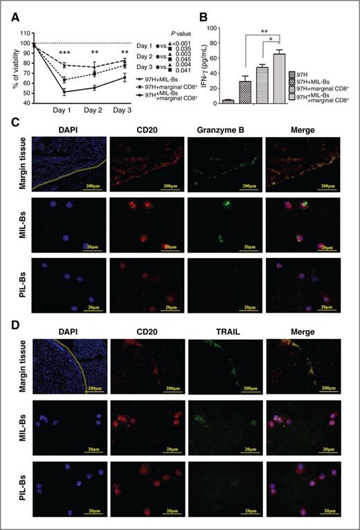Margin-Infiltrating CD20+ B Cells Display an Atypical Memory Phenotype ...