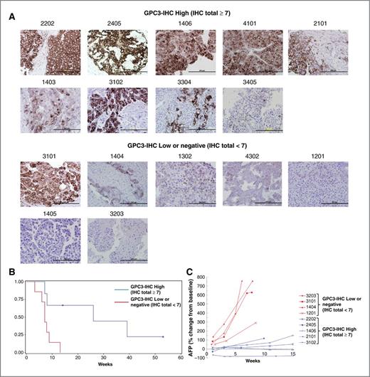 First-in-Man Phase I Study of GC33, a Novel Recombinant Humanized ...
