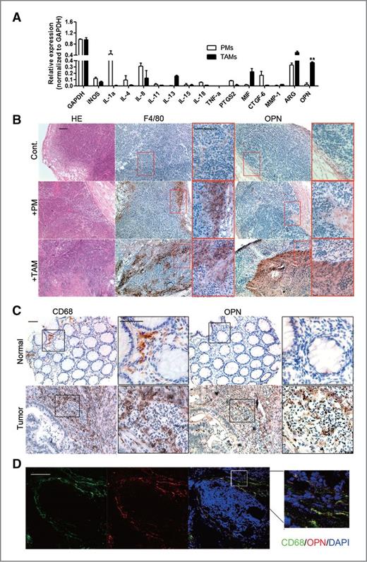 Reciprocal Interactions between Tumor-Associated Macrophages and CD44 ...