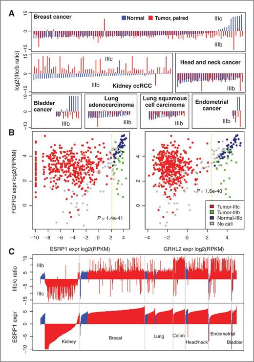 Tumor-Specific Isoform Switch of the Fibroblast Growth Factor Receptor ...