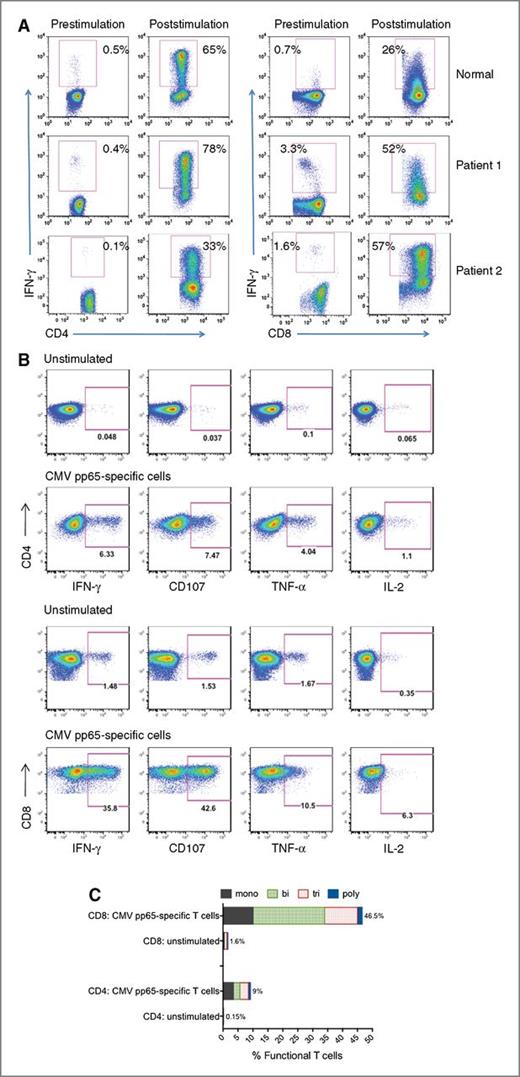 Recognition and Killing of Autologous, Primary Glioblastoma Tumor Cells by Human Cytomegalovirus ...