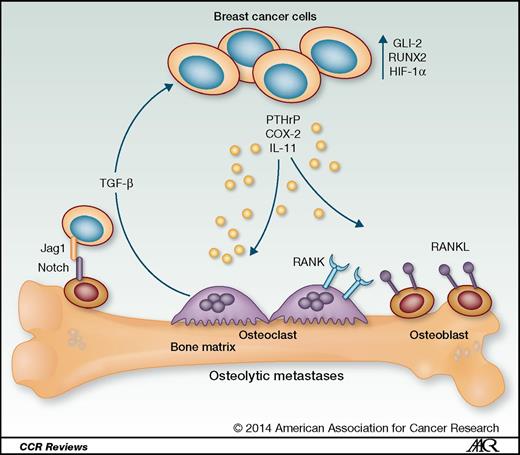 Molecular Mechanisms of Bone Metastasis and Associated Muscle Weakness ...