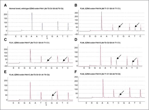 EZH2 Mutations in Follicular Lymphoma from Different Ethnic Groups and ...