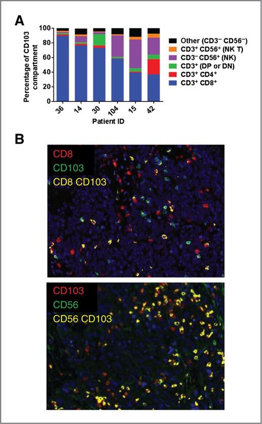 Tumor-Infiltrating Lymphocytes Expressing the Tissue Resident Memory ...
