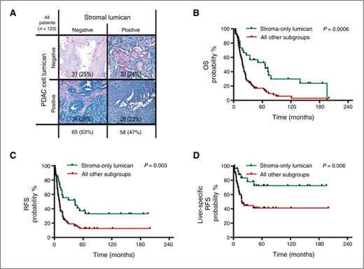 Extracellular Lumican Inhibits Pancreatic Cancer Cell Growth and Is ...