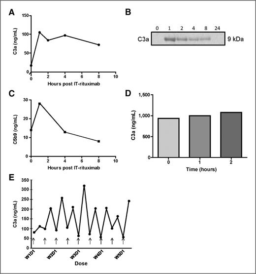 Complement Activation and Intraventricular Rituximab Distribution in ...