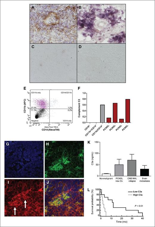 Complement Activation and Intraventricular Rituximab Distribution in ...