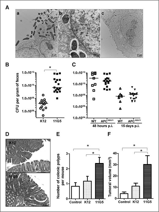 Colonization of the Human Gut by E. coli and Colorectal Cancer Risk ...
