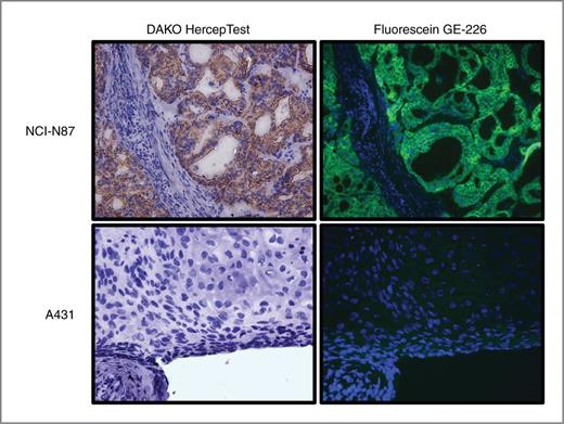 Positron Emission Tomography Imaging with 18F-Labeled ZHER2:2891 ...