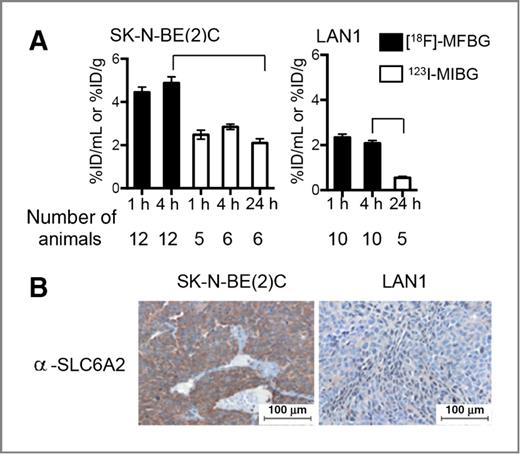 Imaging the Norepinephrine Transporter in Neuroblastoma: A Comparison ...