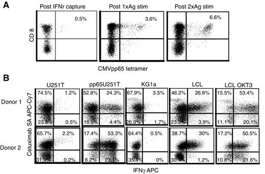 CMVpp65 Vaccine Enhances the Antitumor Efficacy of Adoptively ...