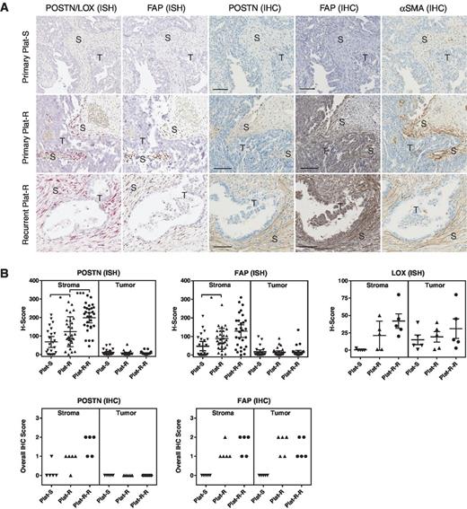 Upregulation of Periostin and Reactive Stroma Is Associated with ...