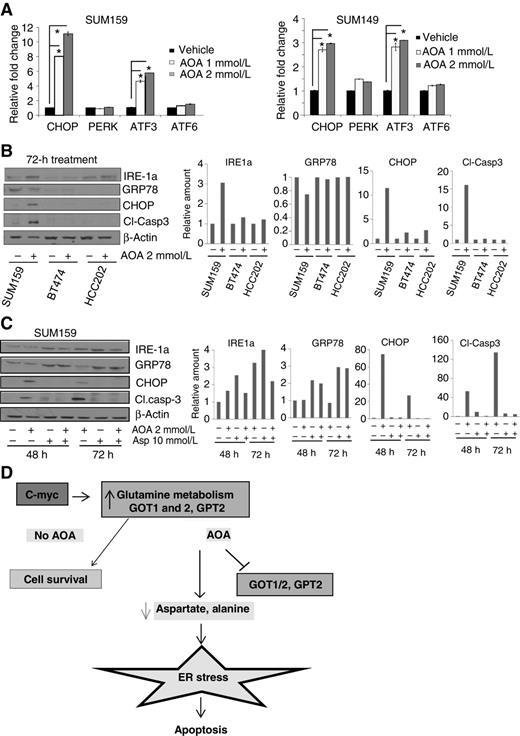Targeting Glutamine Metabolism in Breast Cancer with Aminooxyacetate ...