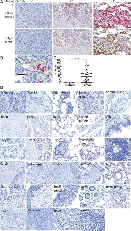 Genetic Engineering of T Cells to Target HERV-K, an Ancient Retrovirus ...