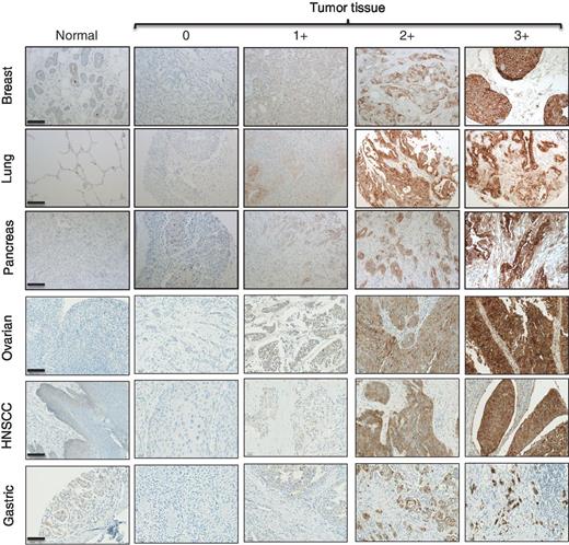 An Antibody–Drug Conjugate Directed against Lymphocyte Antigen 6 ...