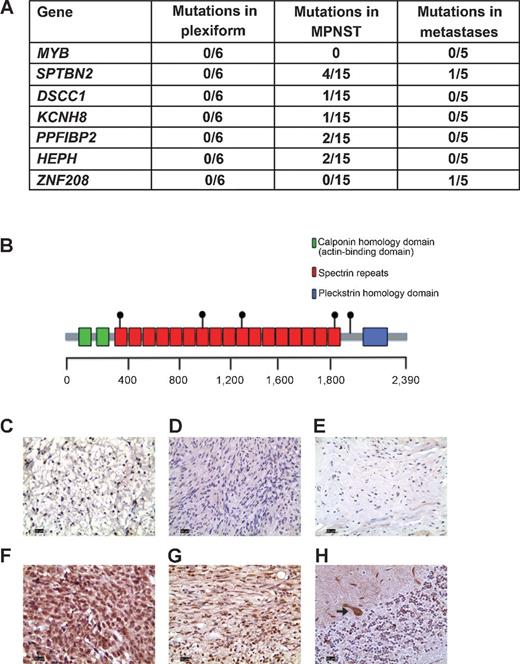 Whole Exome Sequencing Reveals the Order of Genetic Changes during ...
