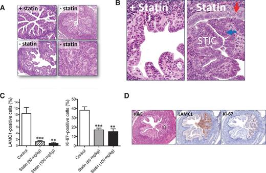 Mevalonate Pathway Antagonist Suppresses Formation of Serous Tubal ...